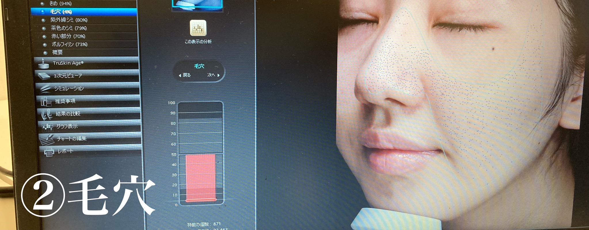 VISIA肌診断で肌の状態を調べてきました | ご自愛美容ブログ